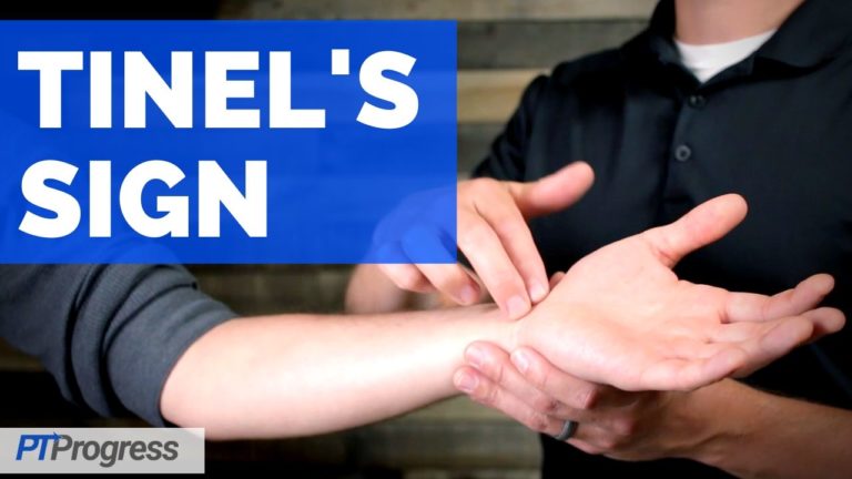 Tinel’s Sign for Carpal Tunnel Syndrome • PTProgress
